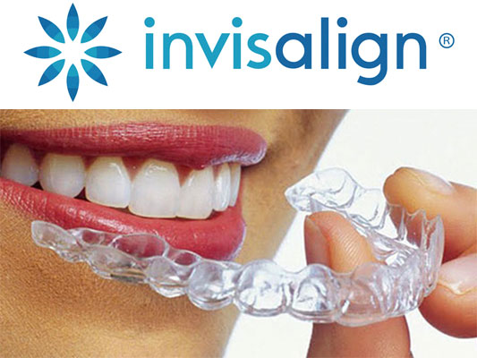 Guide To Living With Invisalign Aligners For NYC PatientsDr Jacquie