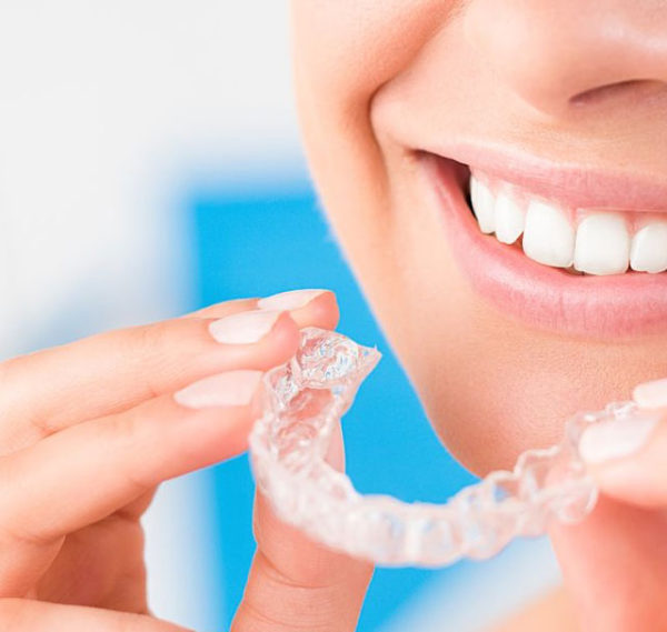 5 Things to Know Before Starting InvisalignDr. Jacquie