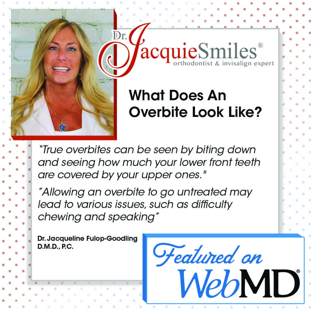 Dr. Jacqueline Fulop-Goodling featured in WebMDDr. Jacquie